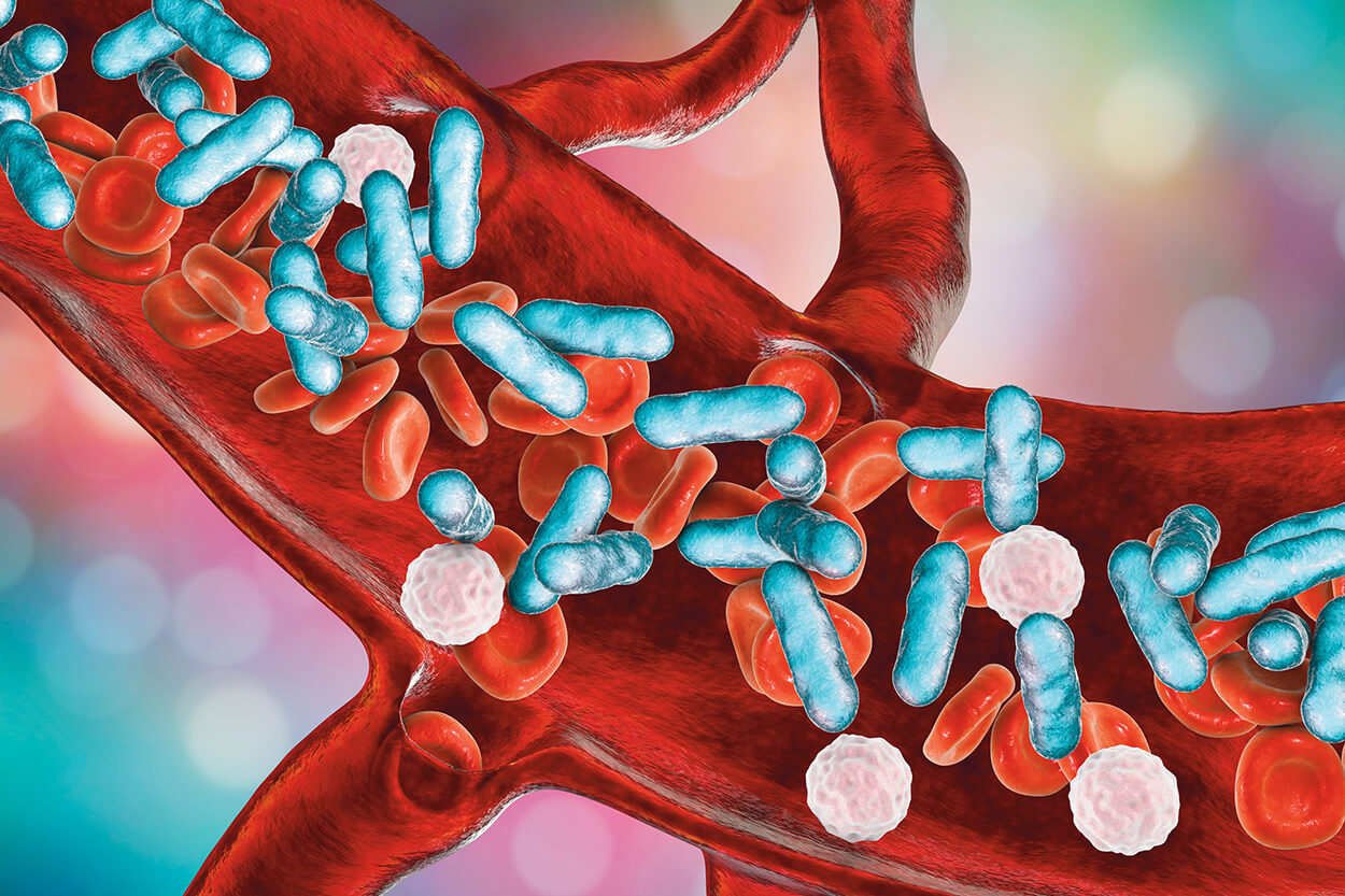 Trending Data: Focus on Sepsis - HealthTrust - Performance Improvement ...